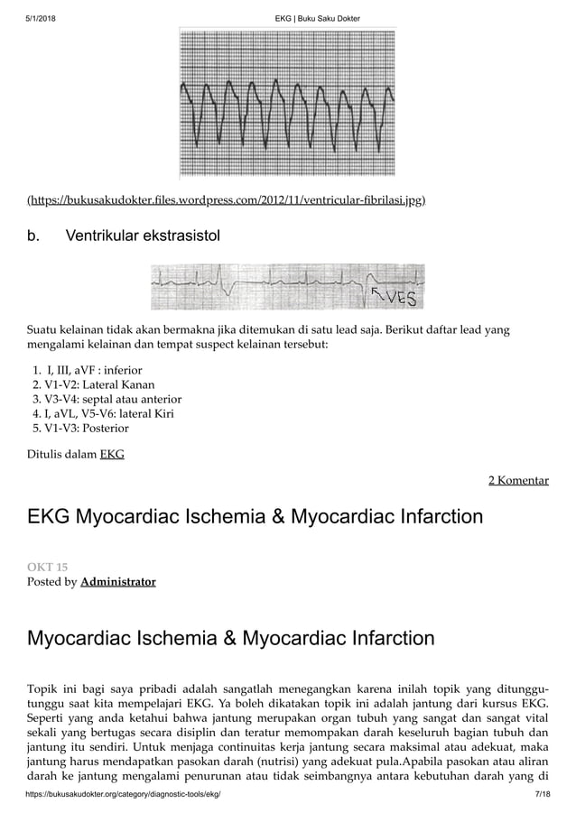 Ekg buku saku dokter | PDF