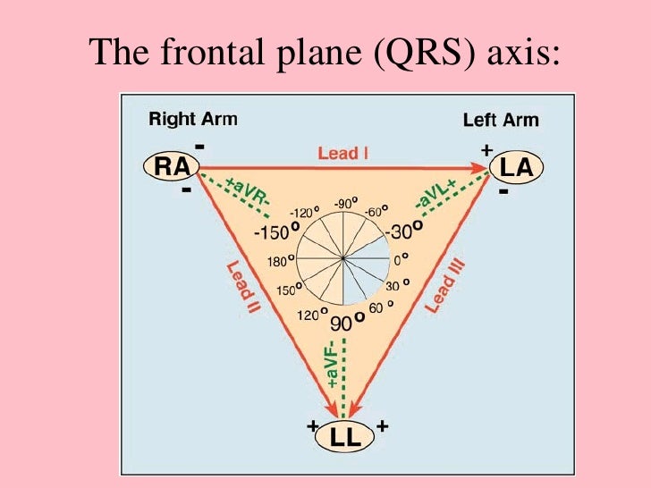 Ekg Cases 7 15 09 Level 2 Part 1