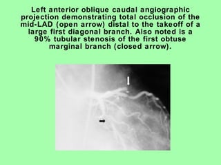 Ekg Cases Jul09.Level One Part 1 | PPT