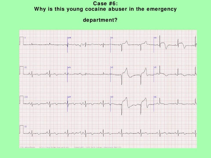 Ekg Cases Jul09.Level One Part 1