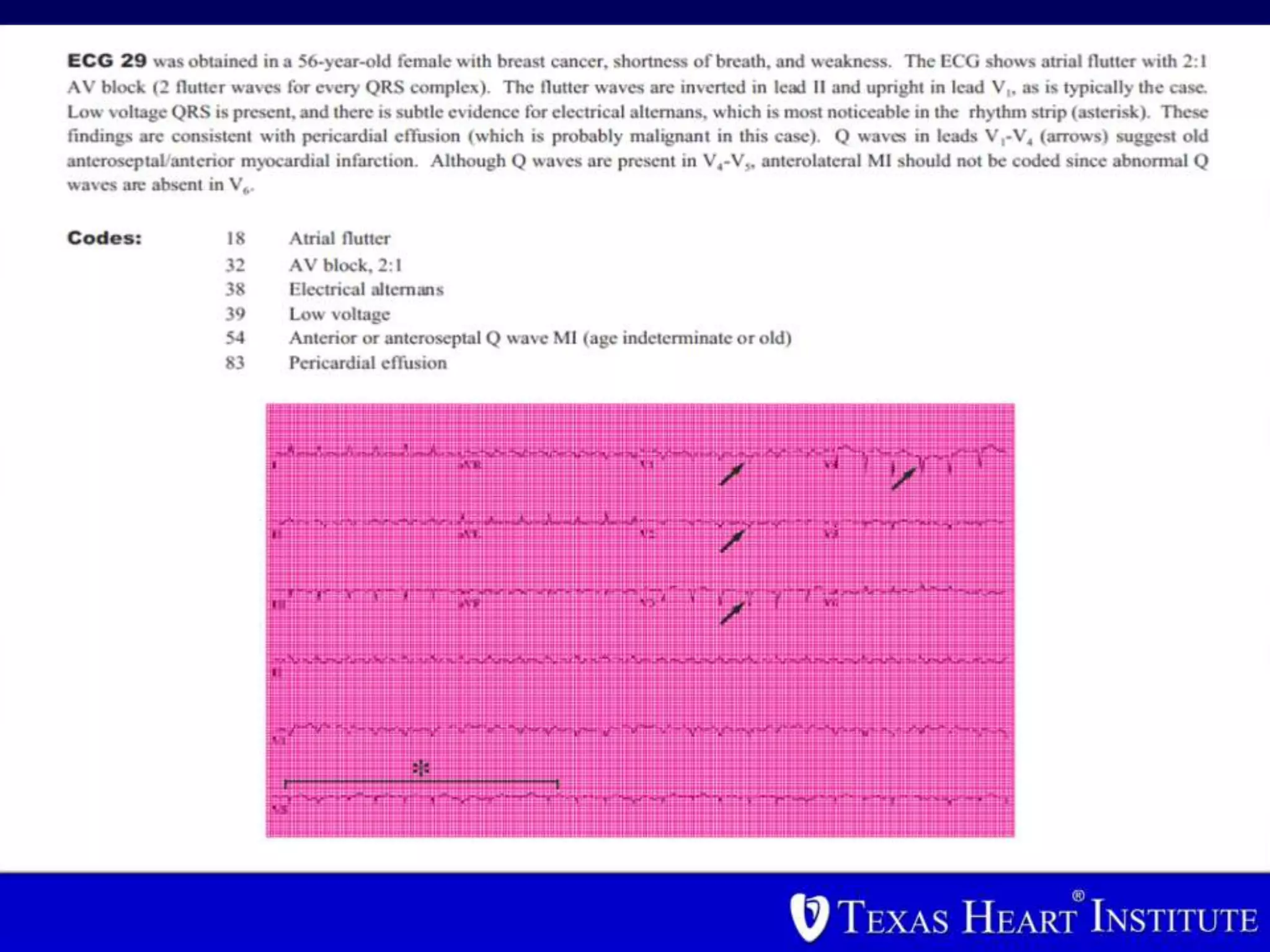 EKG for cardiology Board review | PPTX