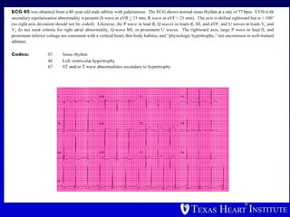EKG for cardiology Board review | PPTX