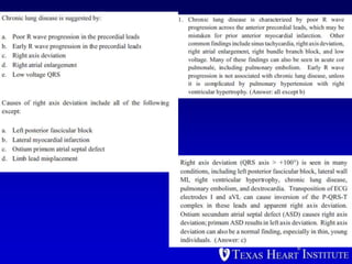 EKG for cardiology Board review | PPTX