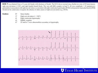EKG for cardiology Board review | PPTX