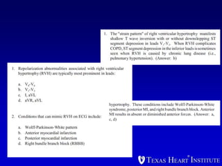 EKG for cardiology Board review | PPTX