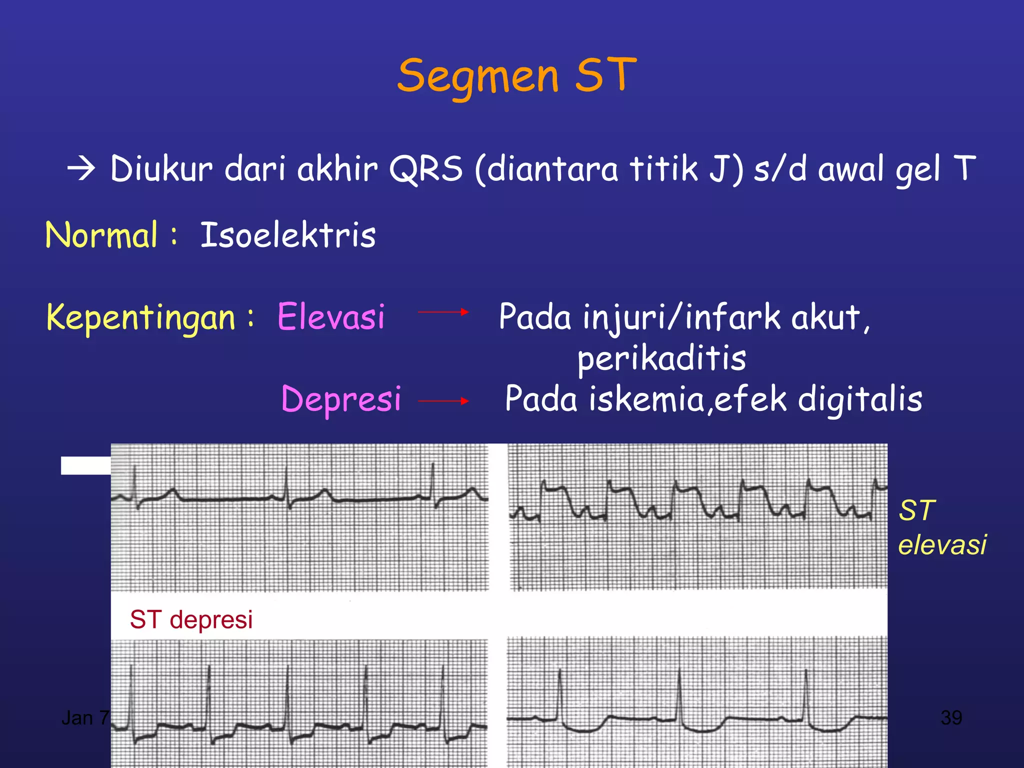 Ekg dasar | PPT