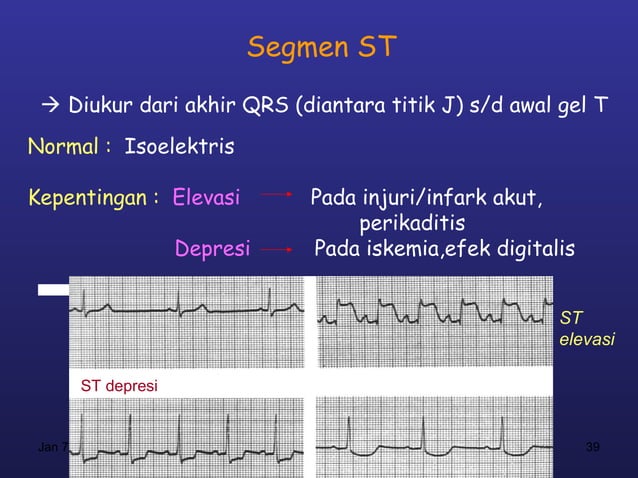 Ekg dasar | PPT