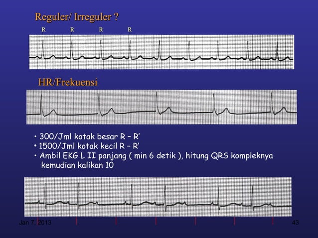 Ekg dasar | PPT