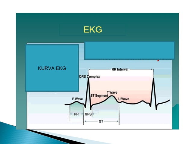 EKG DASAR | PPT