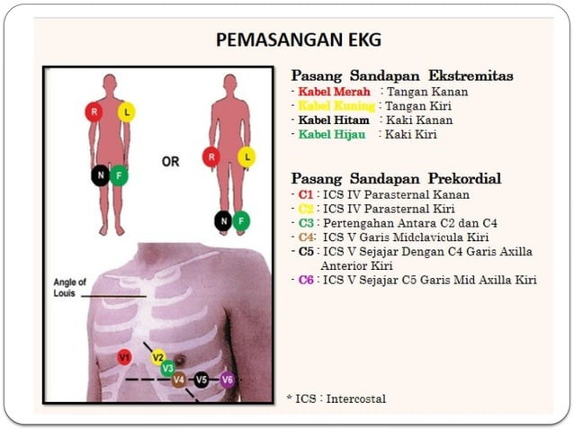 EKG DASAR PEMERIKSAAN PENUNJANG JANTUNG.pptx