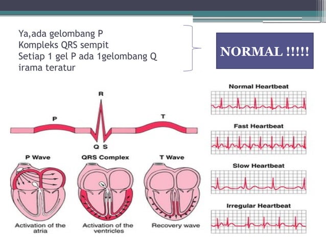 EKG DASAR BAHAN AJAR.pdf
