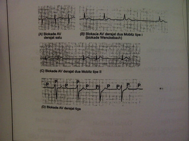 EKG DASAR BAHAN AJAR.pdf
