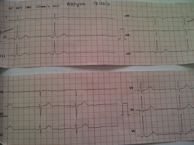 EKG DASAR BAHAN AJAR.pdf