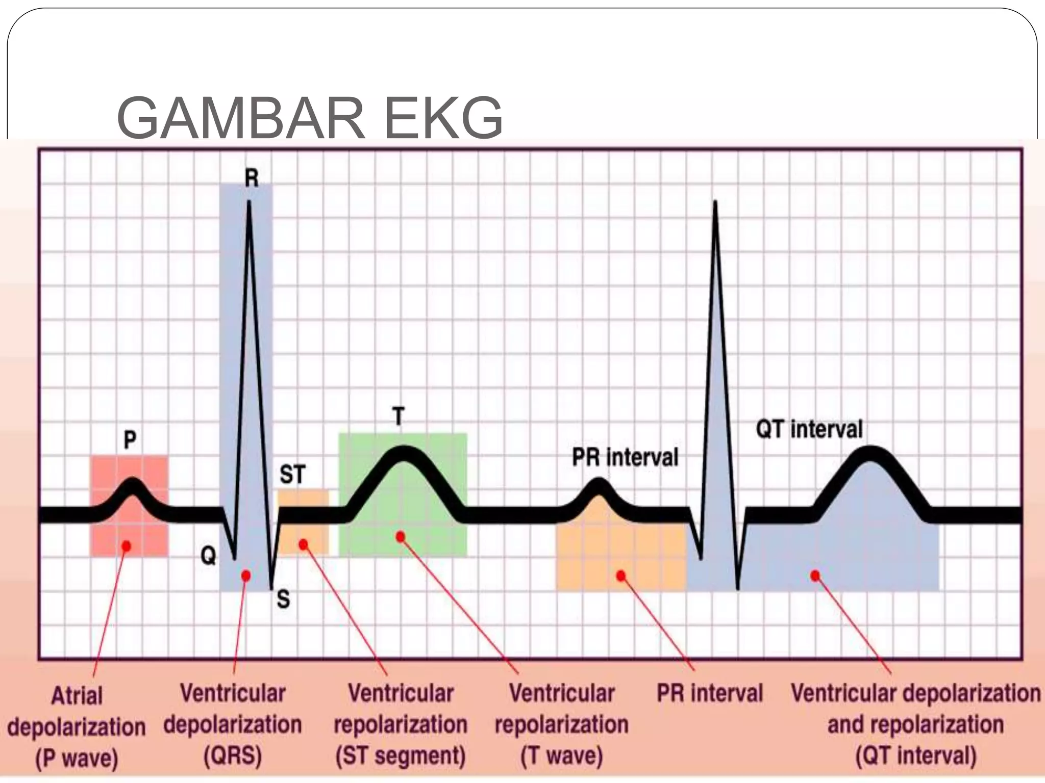EKG Dasar dan Cara Interpretasi.pptx