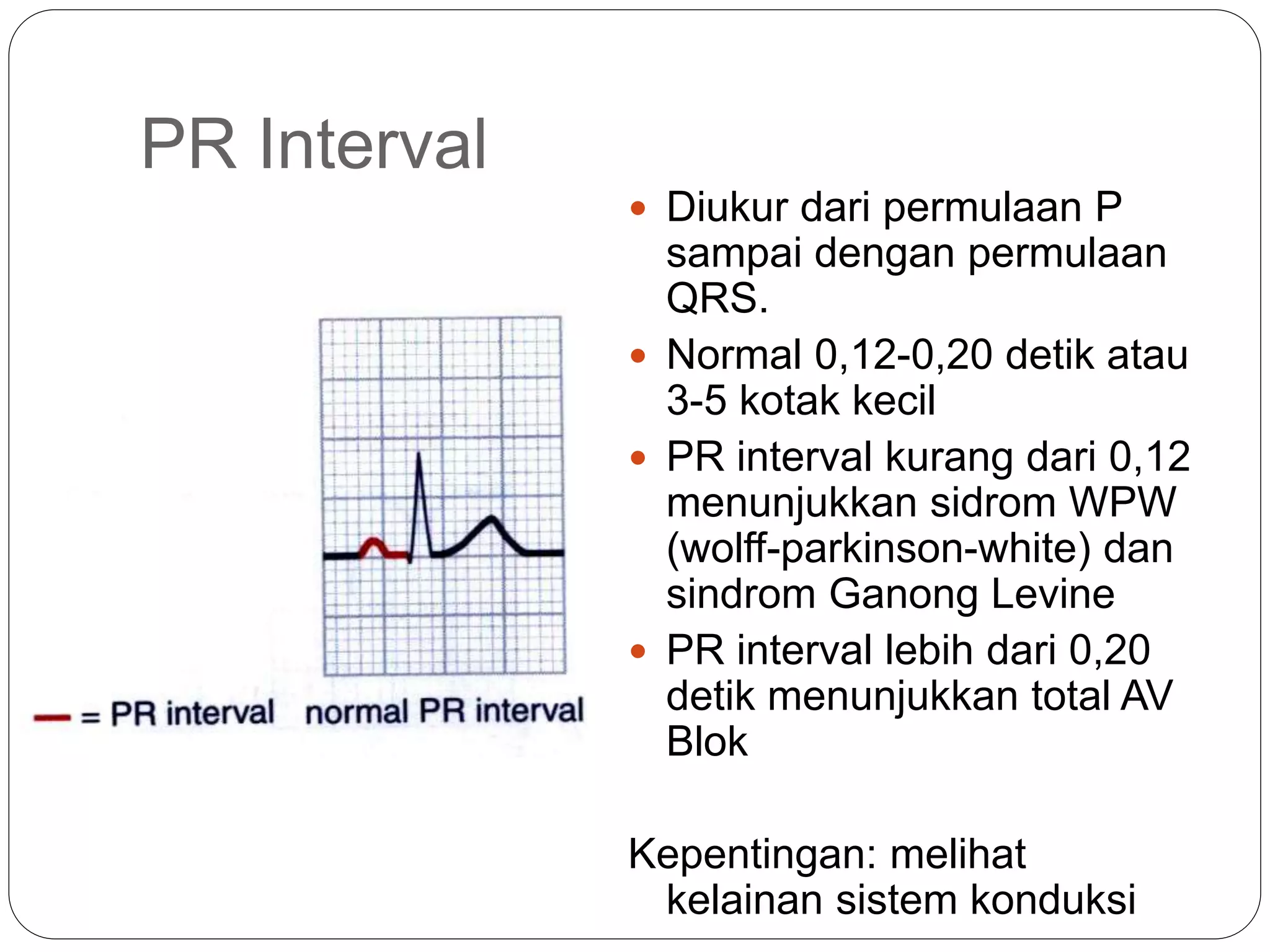 EKG Dasar dan Cara Interpretasi.pptx