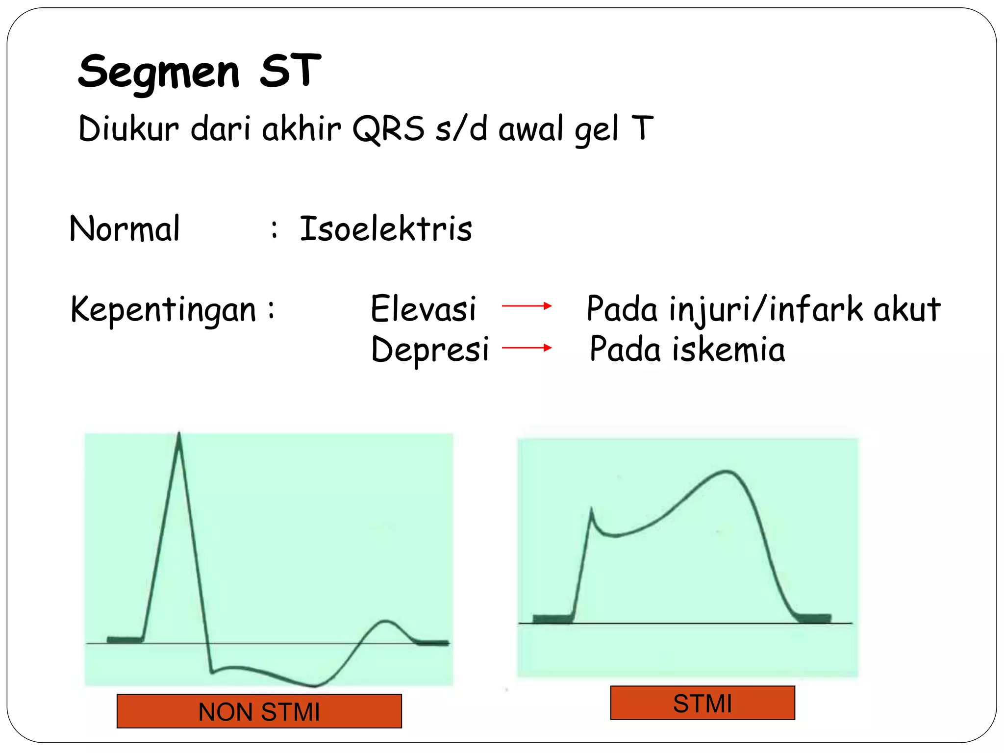 EKG Dasar dan Cara Interpretasi.pptx
