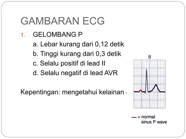 EKG Dasar dan Cara Interpretasi.pptx
