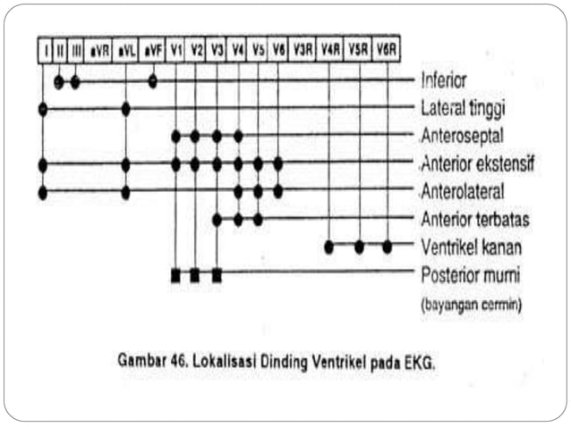 EKG Dasar dan Cara Interpretasi.pptx