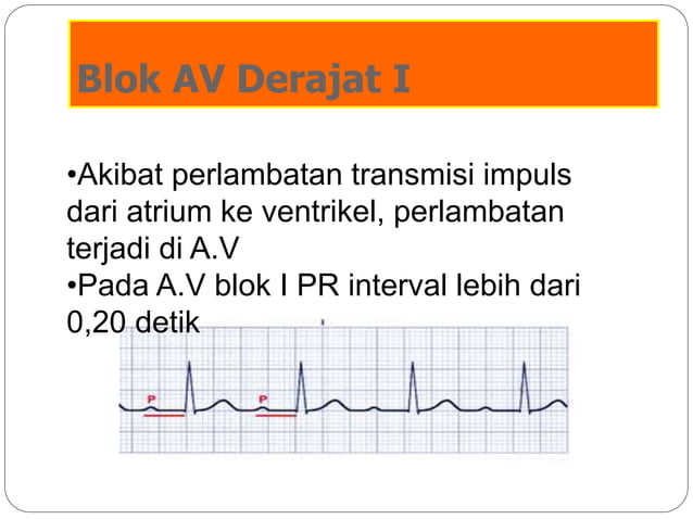 EKG Dasar dan Cara Interpretasi.pptx