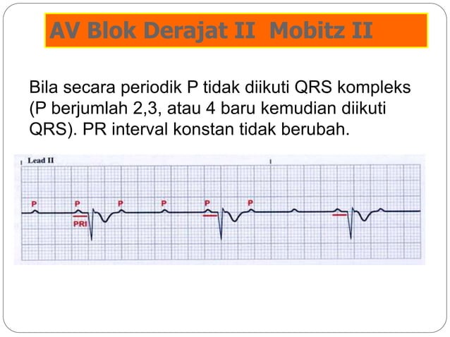 EKG Dasar dan Cara Interpretasi.pptx