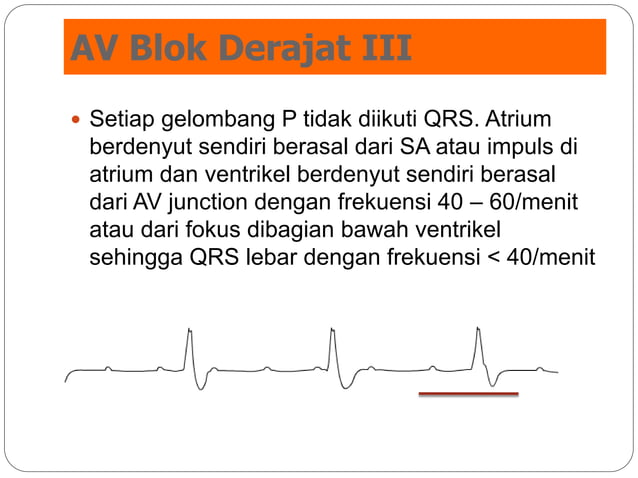 EKG Dasar dan Cara Interpretasi.pptx