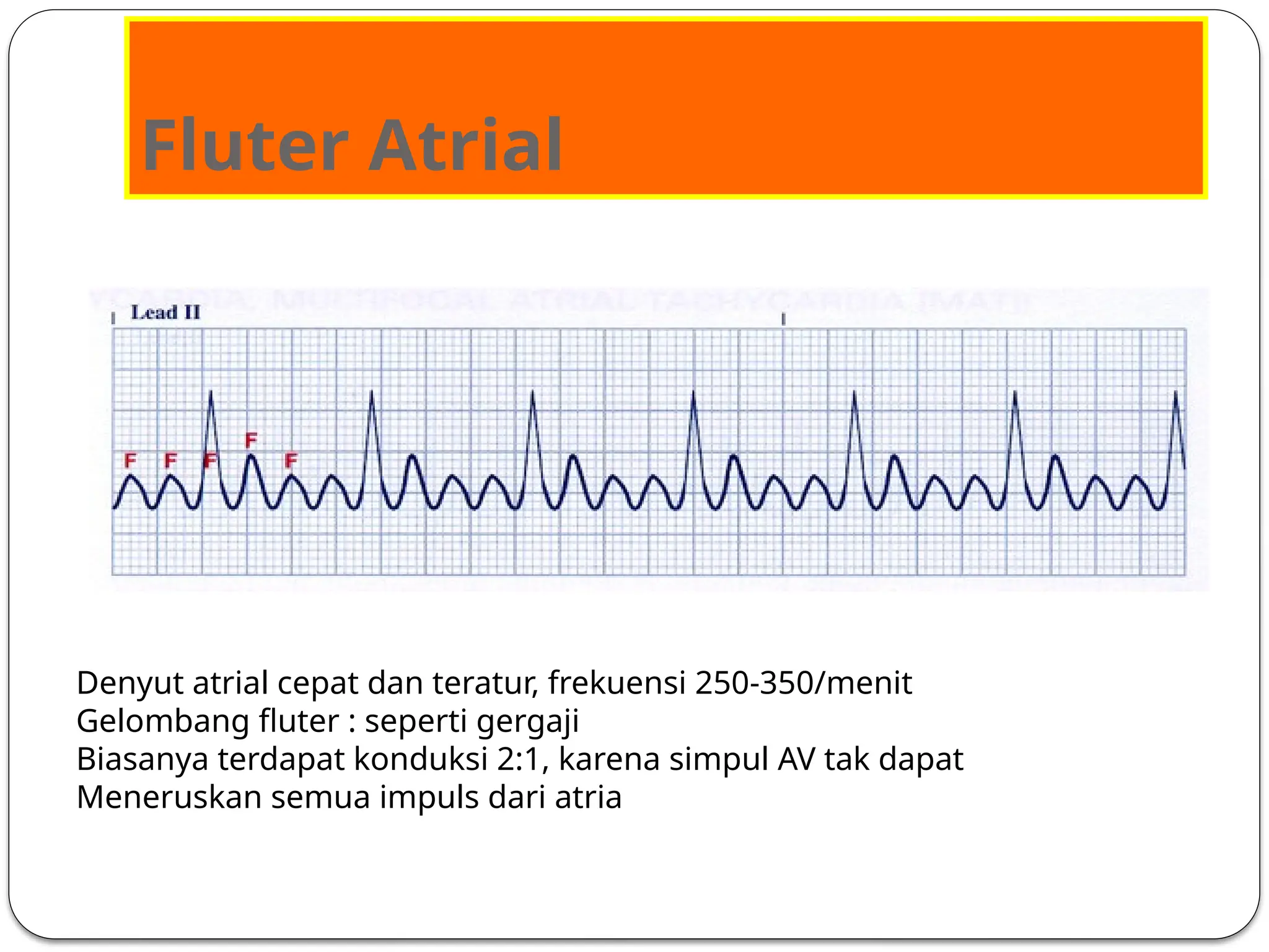 Konsep EKG_Dasar_dan_Cara_Interpretasi.pptx