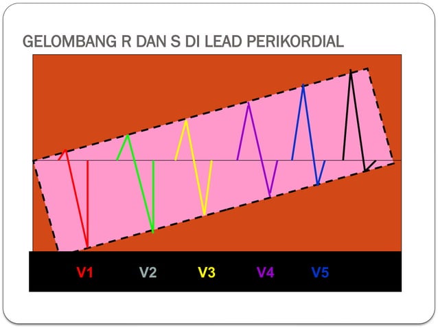 Konsep EKG_Dasar_dan_Cara_Interpretasi.pptx