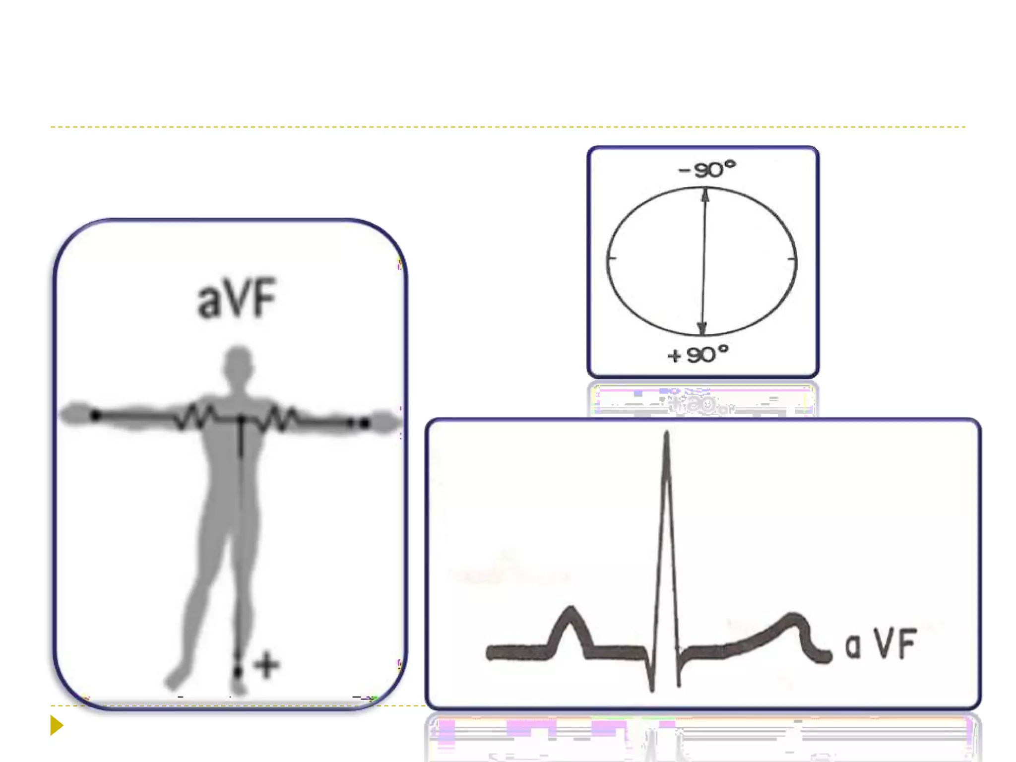 EKG DE ARRITMIAS SUPRAVENTRICULARES.pdf