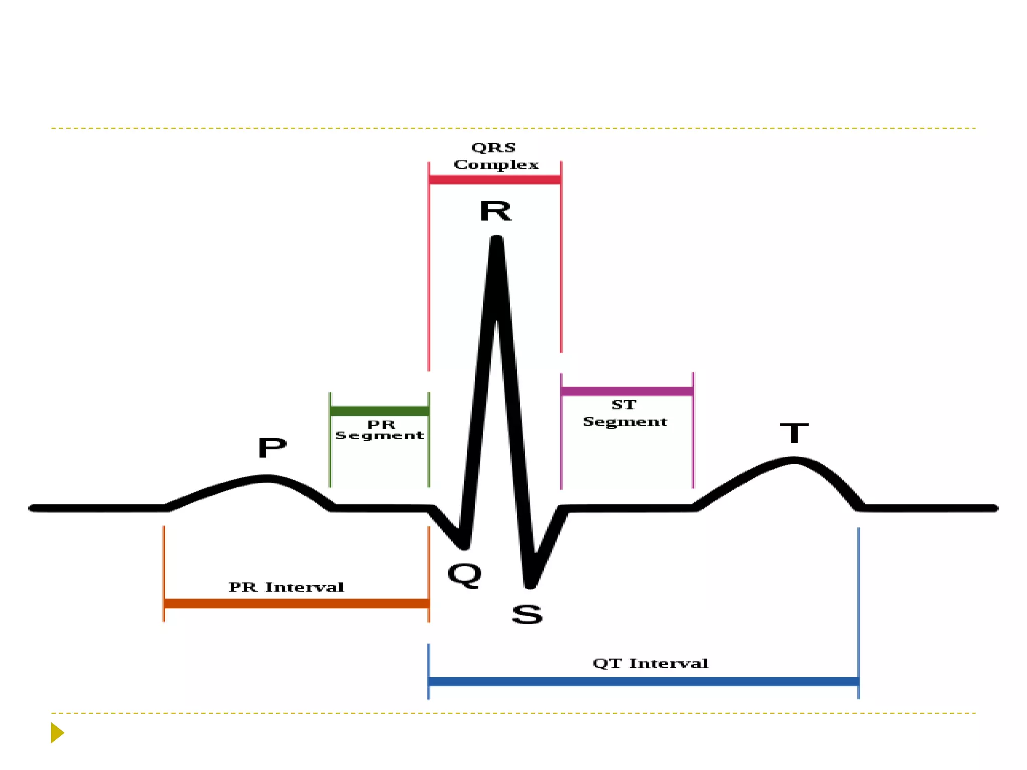 EKG DE ARRITMIAS SUPRAVENTRICULARES.pdf