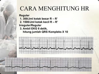 Ekg dr anjang | PPTX