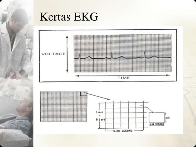 Ekg dr anjang
