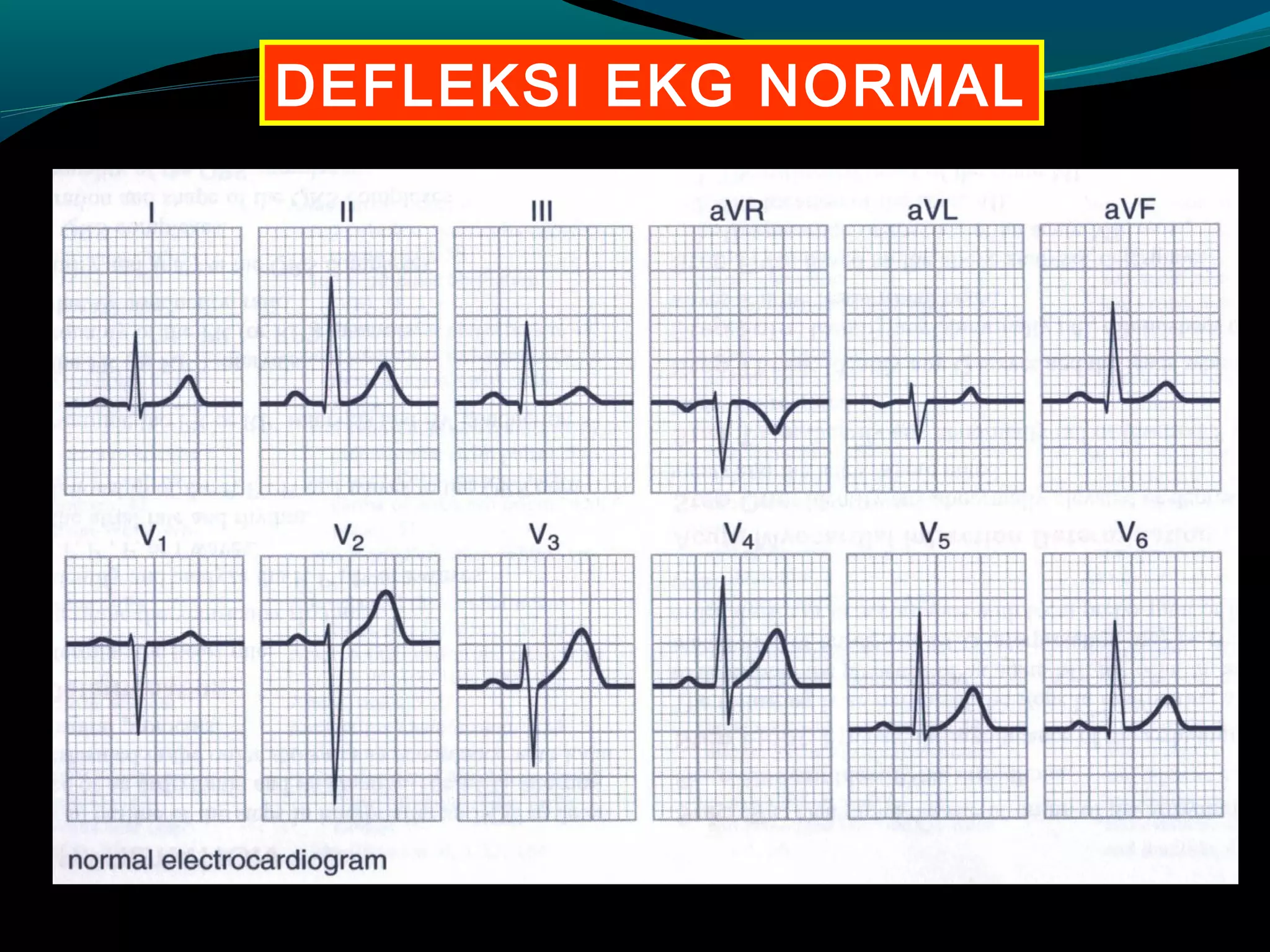 EKG, Drug dan Defibrilator | PPT