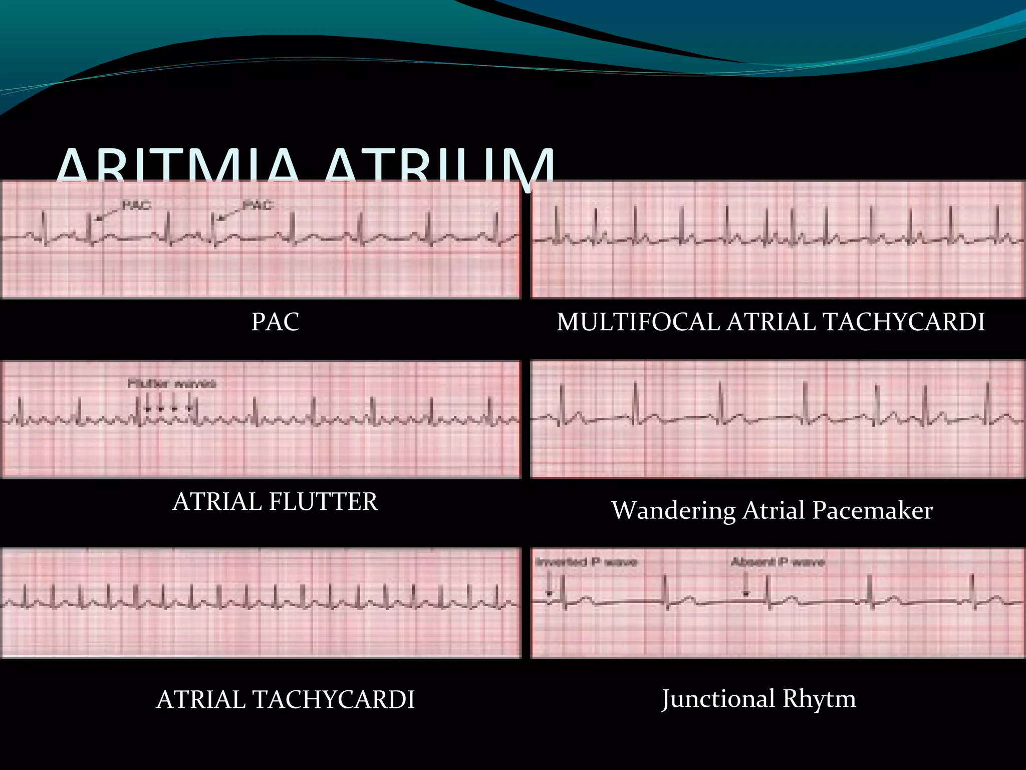 EKG, Drug dan Defibrilator | PPT
