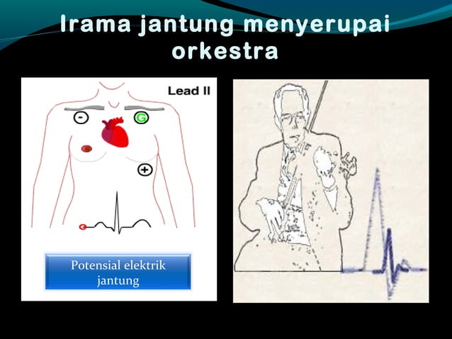 EKG, Drug dan Defibrilator | PPT