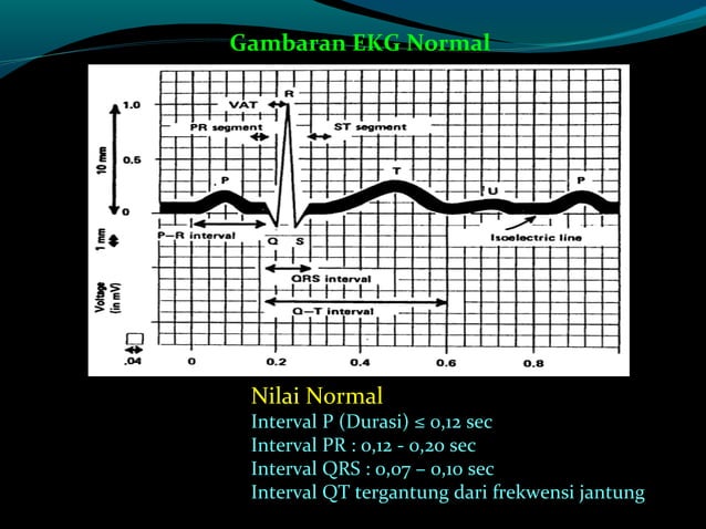 EKG, Drug dan Defibrilator | PPT