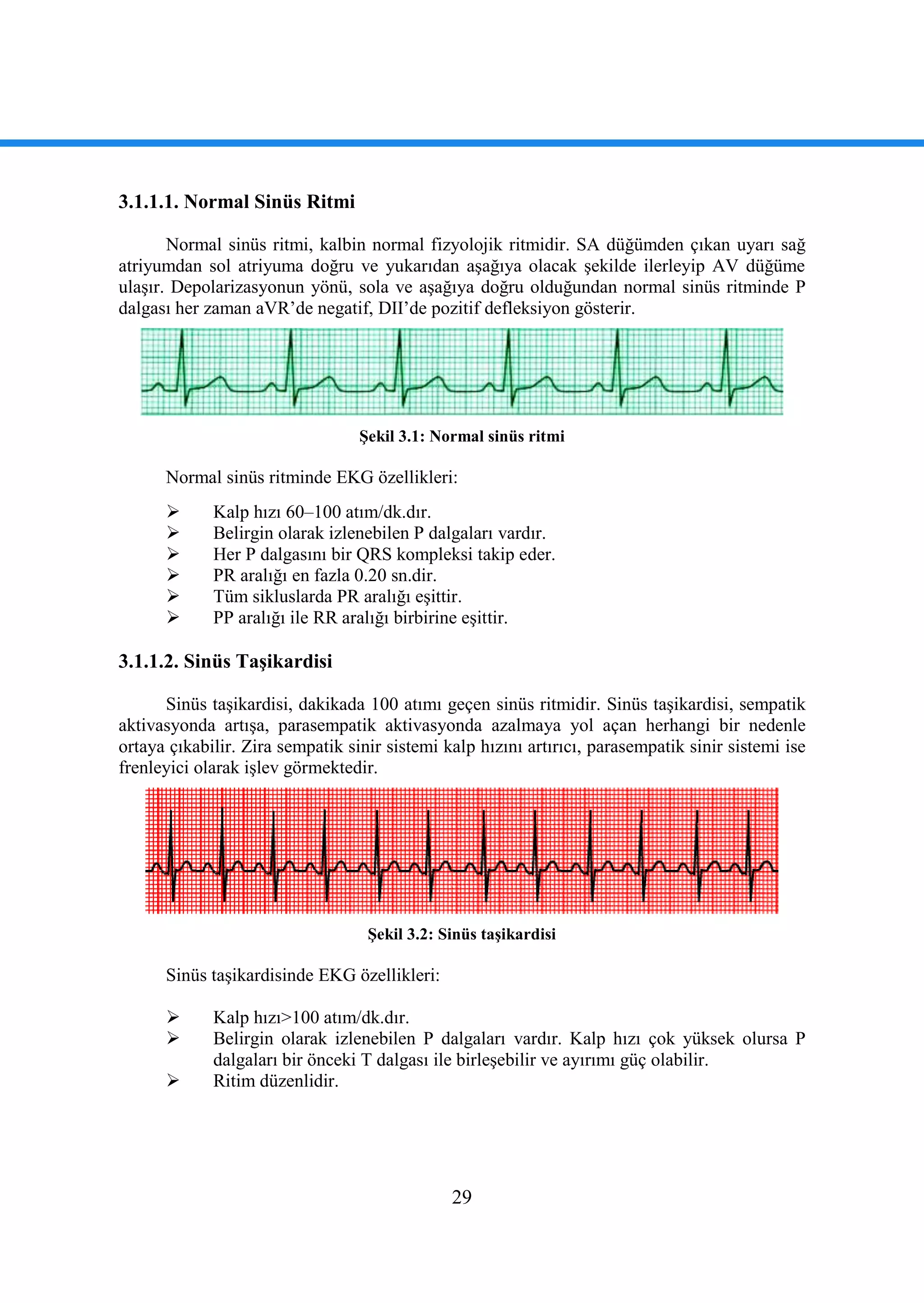 Ekg (elektrokardiografi) | PDF
