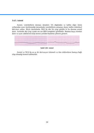 Ekg (elektrokardiografi) | PDF