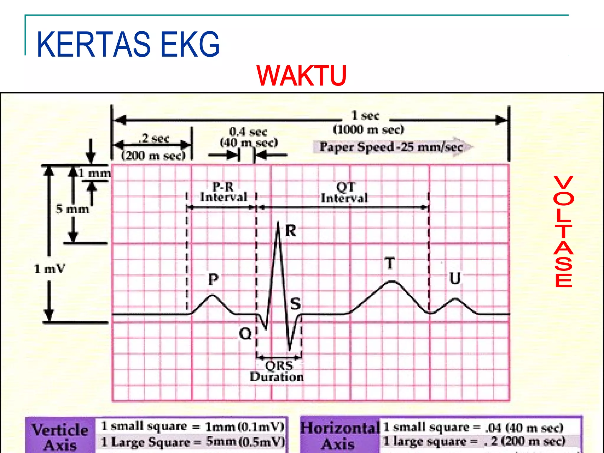 EKG | PPT