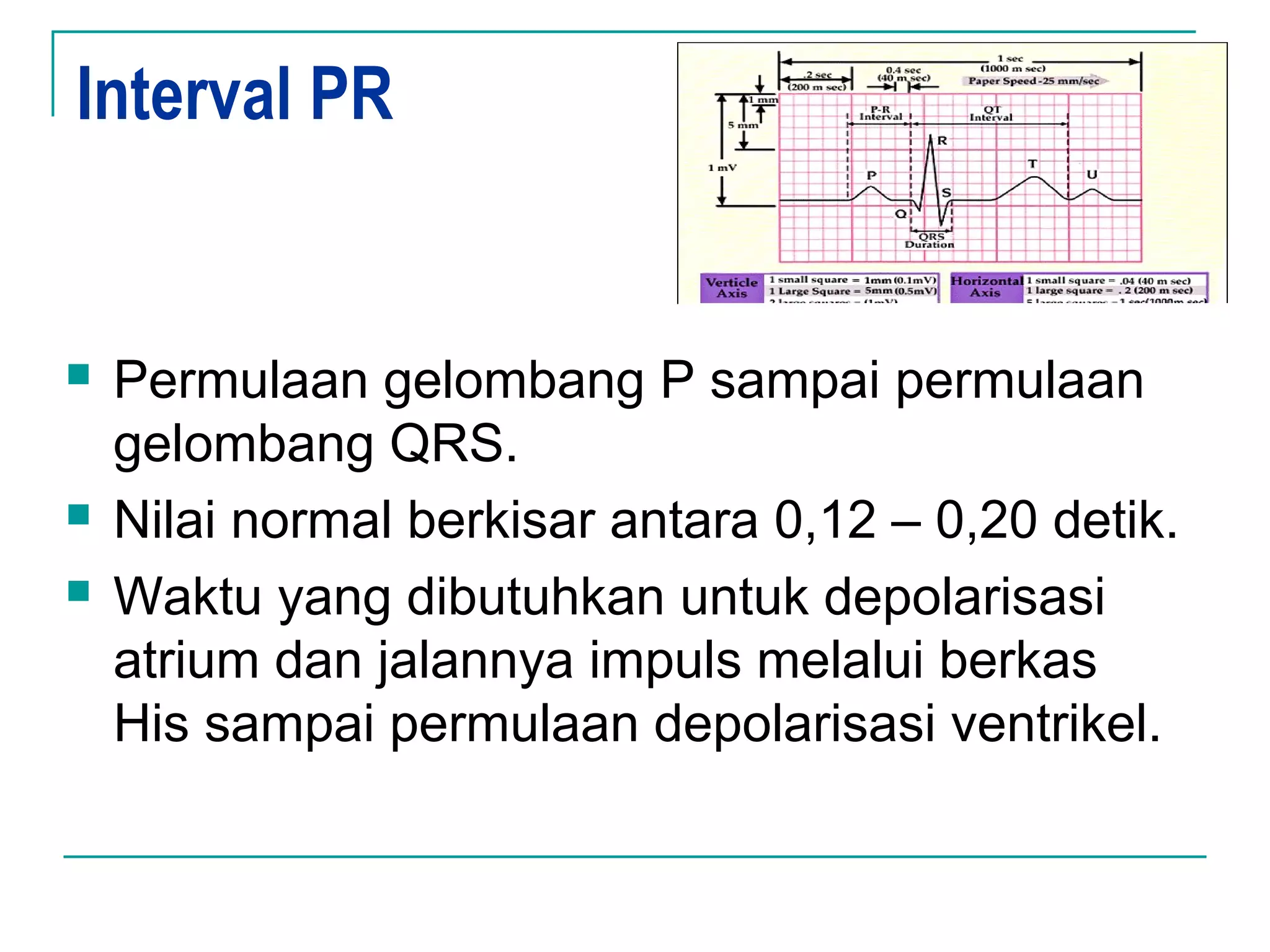 EKG | PPT