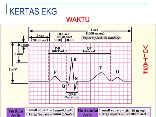 EKG | PPT