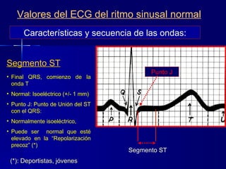 seguridad arpón Ropa punto j del electrocardiograma origen Arte Reductor