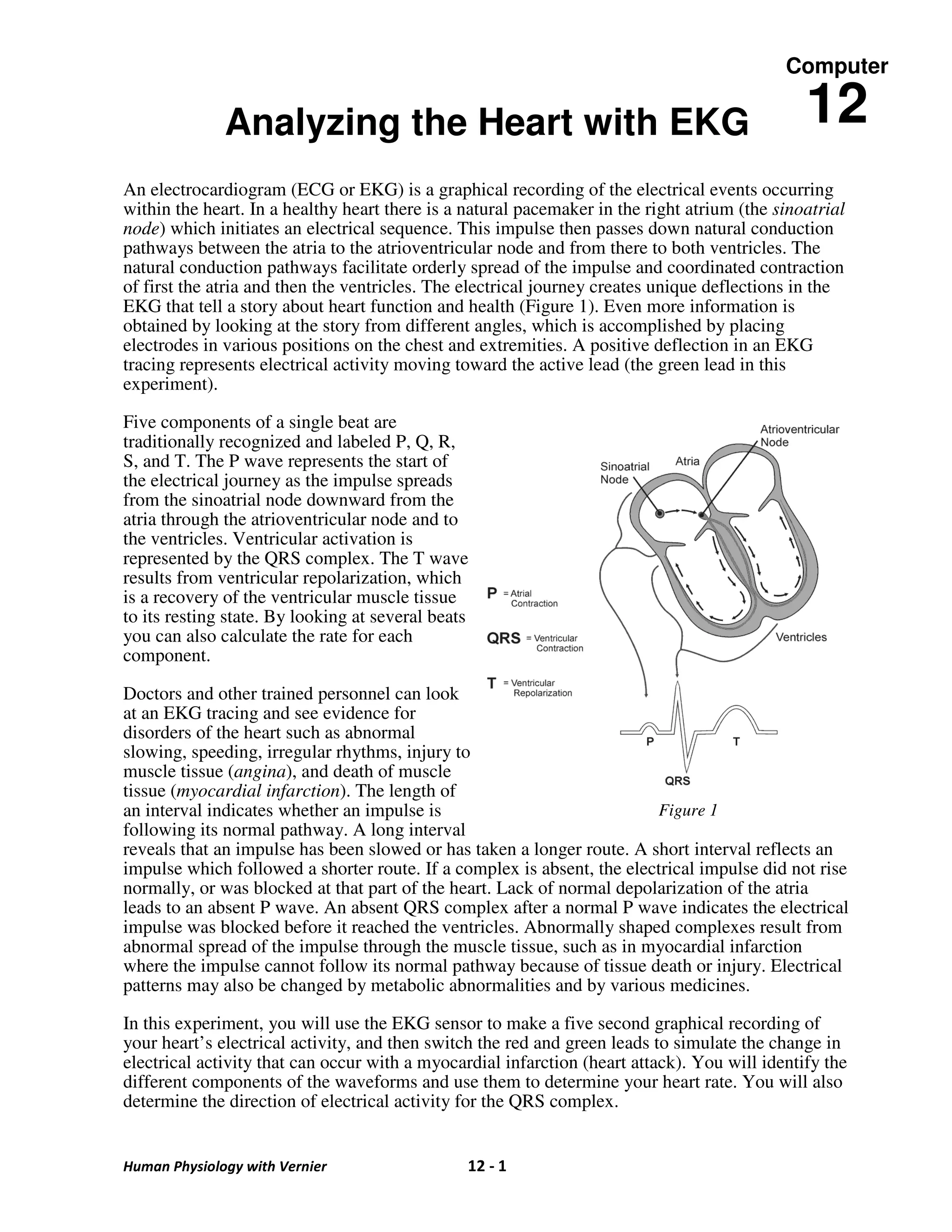 Ekg experiment 3 | PDF
