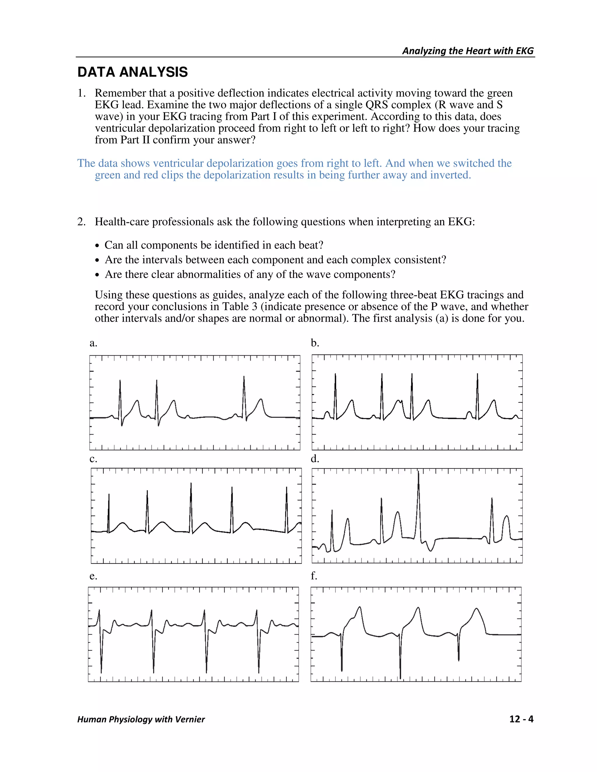 Ekg experiment 3 | PDF