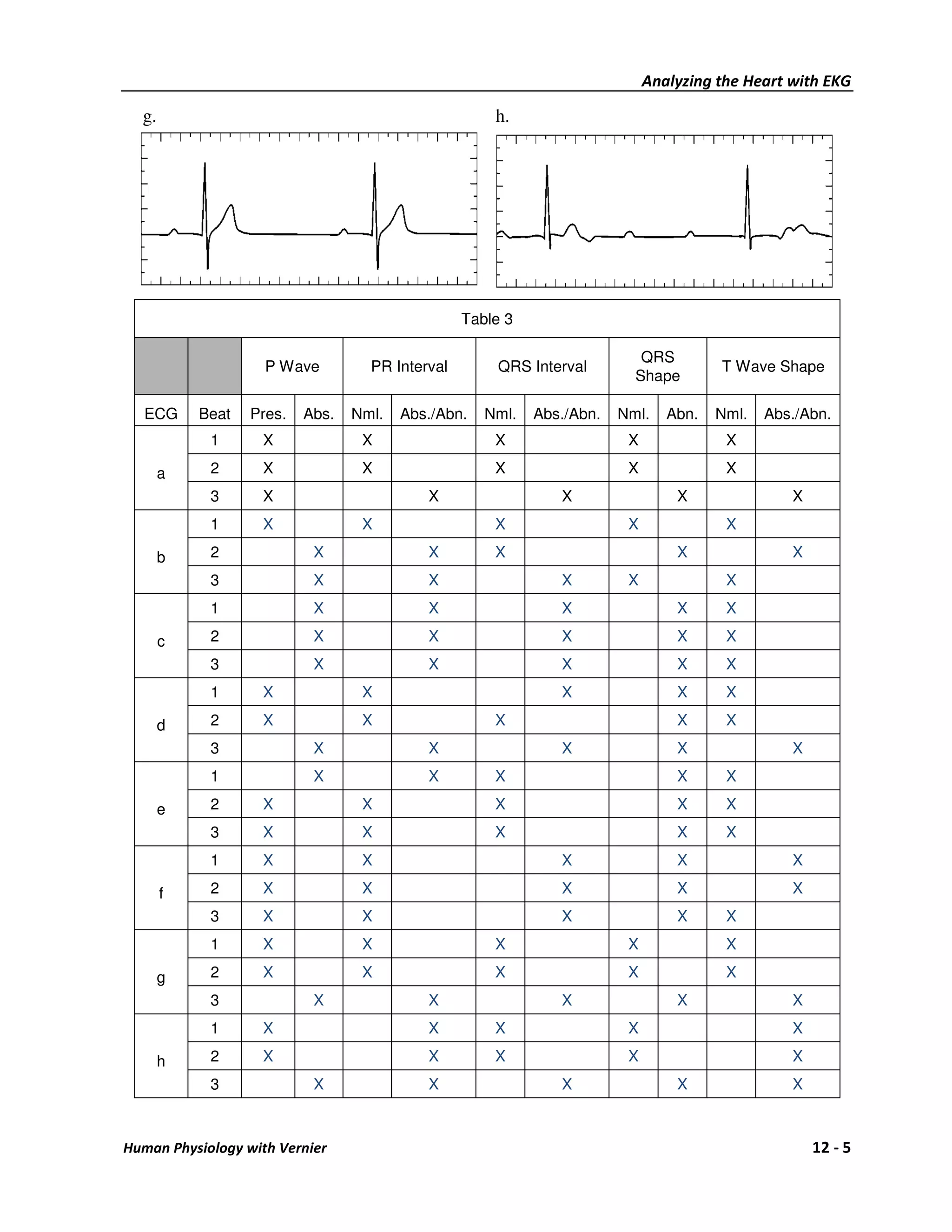 Ekg experiment 3 | PDF