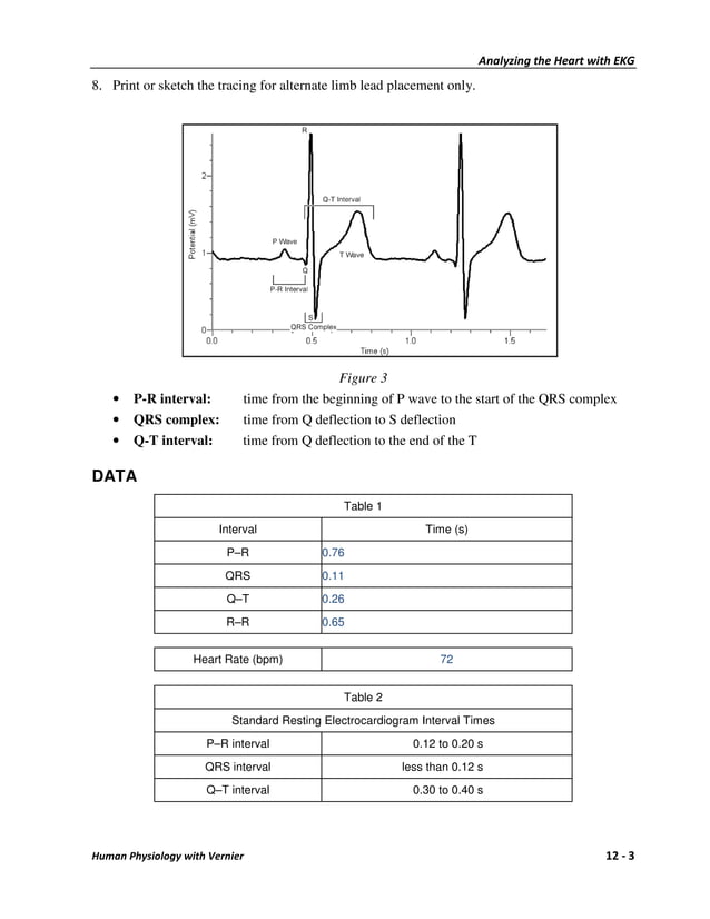 Ekg experiment 3 | PDF