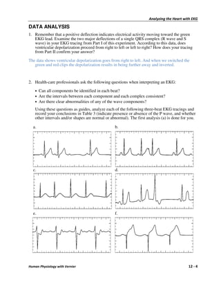Ekg experiment 3 | PDF