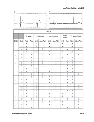 Ekg experiment 3 | PDF