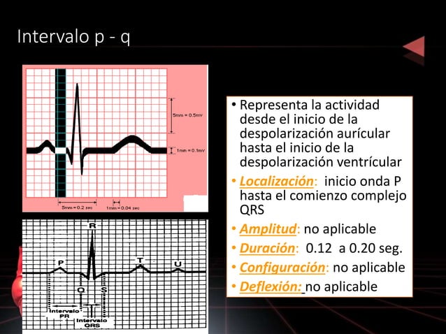 Electrocardiograma | PPTX