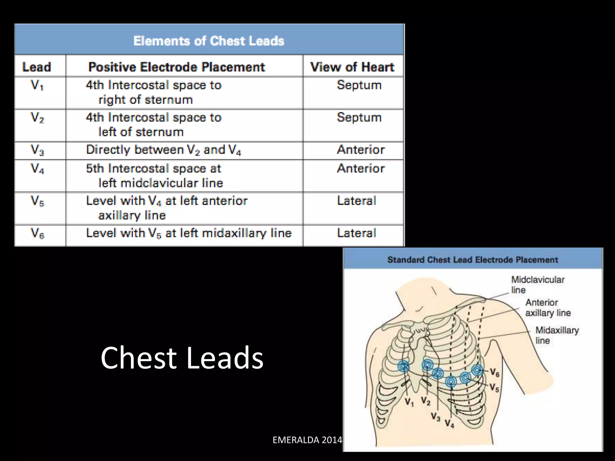 Belajar Baca EKG | PPTX