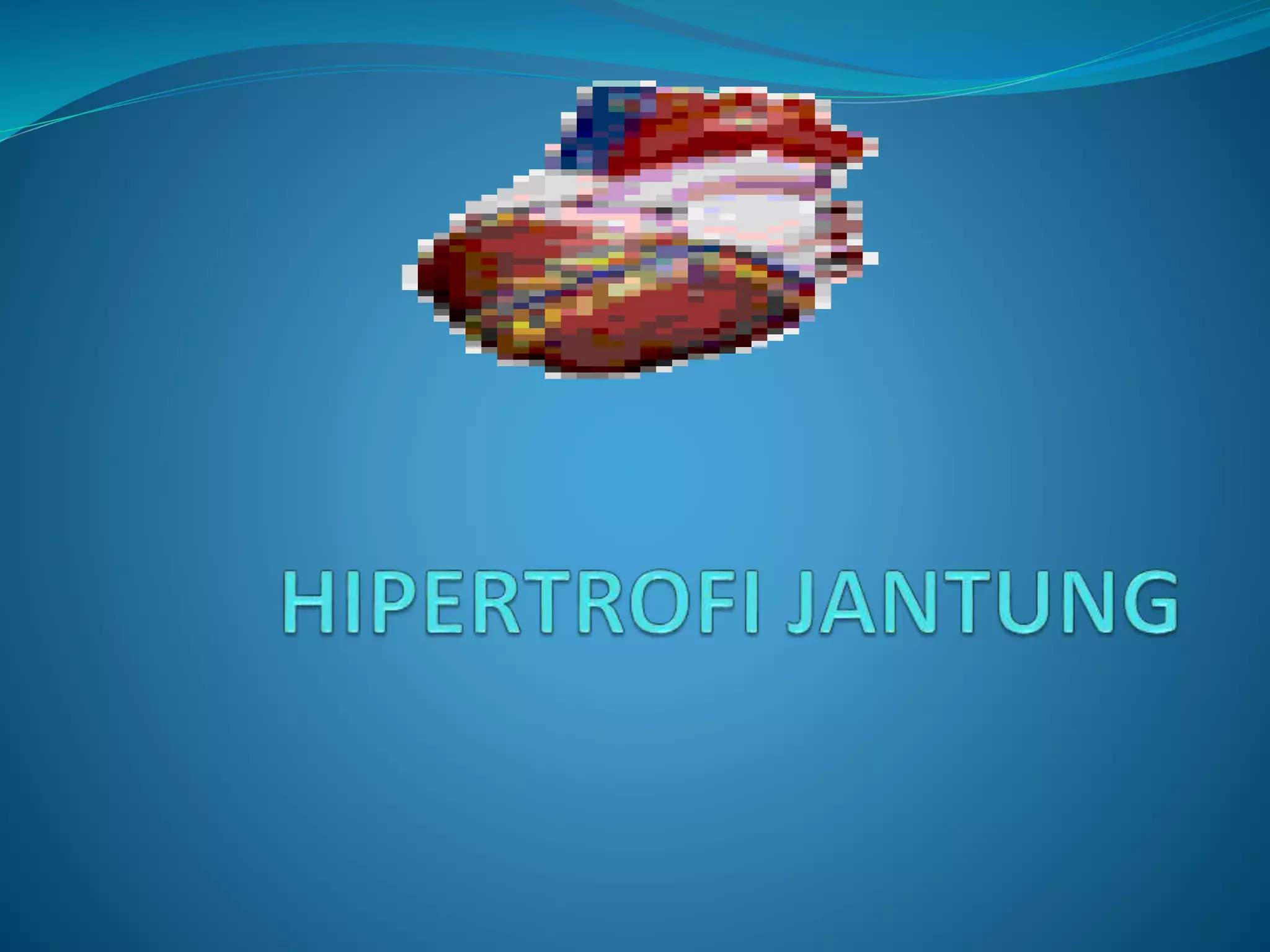 EKG, Hipertrofi Jantung | PPTX